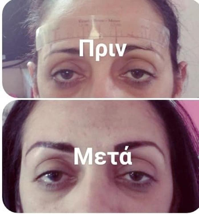 ΚΕΝΤΡΟ ΑΙΣΘΗΤΙΚΗΣ ΑΓΙΟΣ ΔΗΜΗΤΡΙΟΣ ΑΤΤΙΚΗΣ | AESTHETIC DERMA CENTER-ADC ...