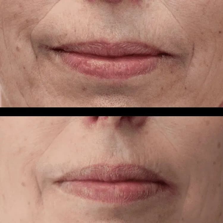 ΚΕΝΤΡΟ ΑΙΣΘΗΤΙΚΗΣ ΑΝΩ ΠΑΤΗΣΙΑ ΑΘΗΝΑ | GLOW AND GO » BeautyBooking.gr
